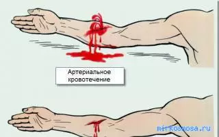 Chảy máu - Giấc mơ tâm lý của Samokhanov