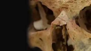 بقایای انسانی با تعداد قابل توجهی از شکستگی ها توسط باستان شناسان در قلمرو استوروپول یافت شد.