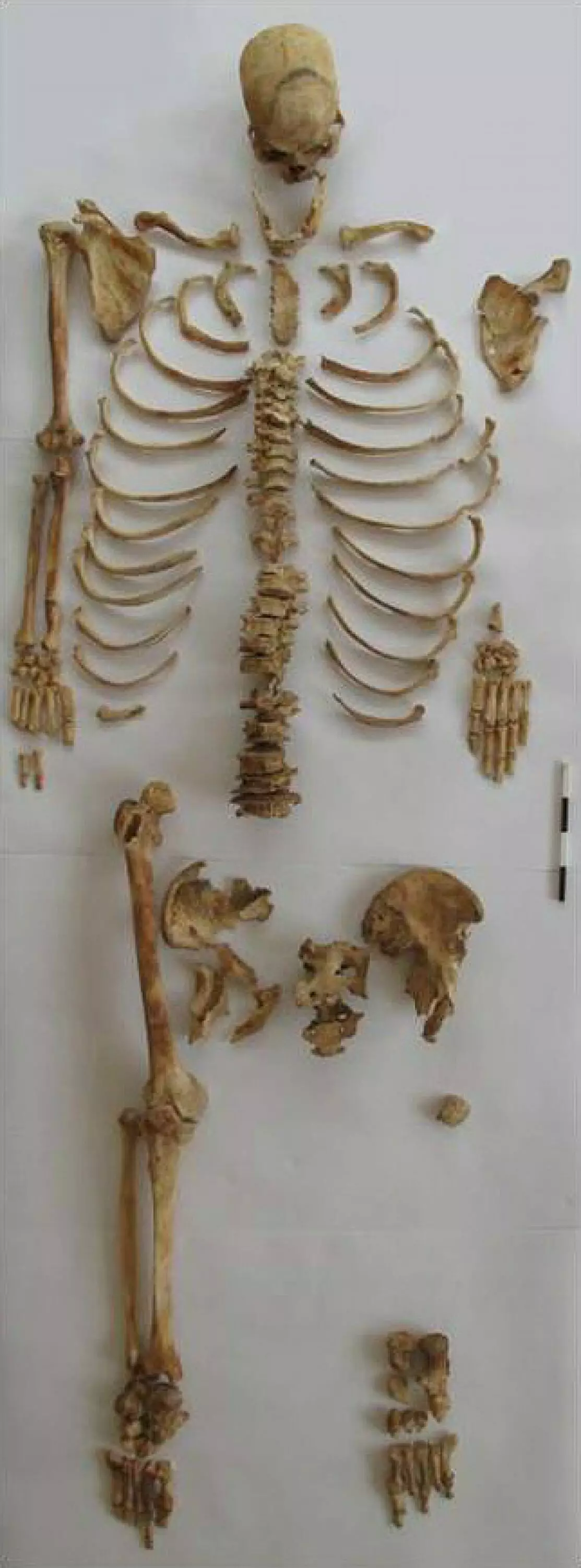 השרידים האנושיים עם מספר מרשים של שברים נמצאו על ידי ארכיאולוגים בשטח Stavropol.